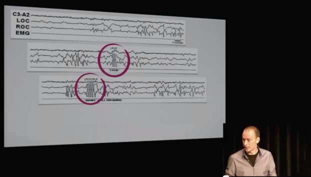 Tim Post from Snoozon talks about Lucid Dreaming at TEDxTwenteU « You ...